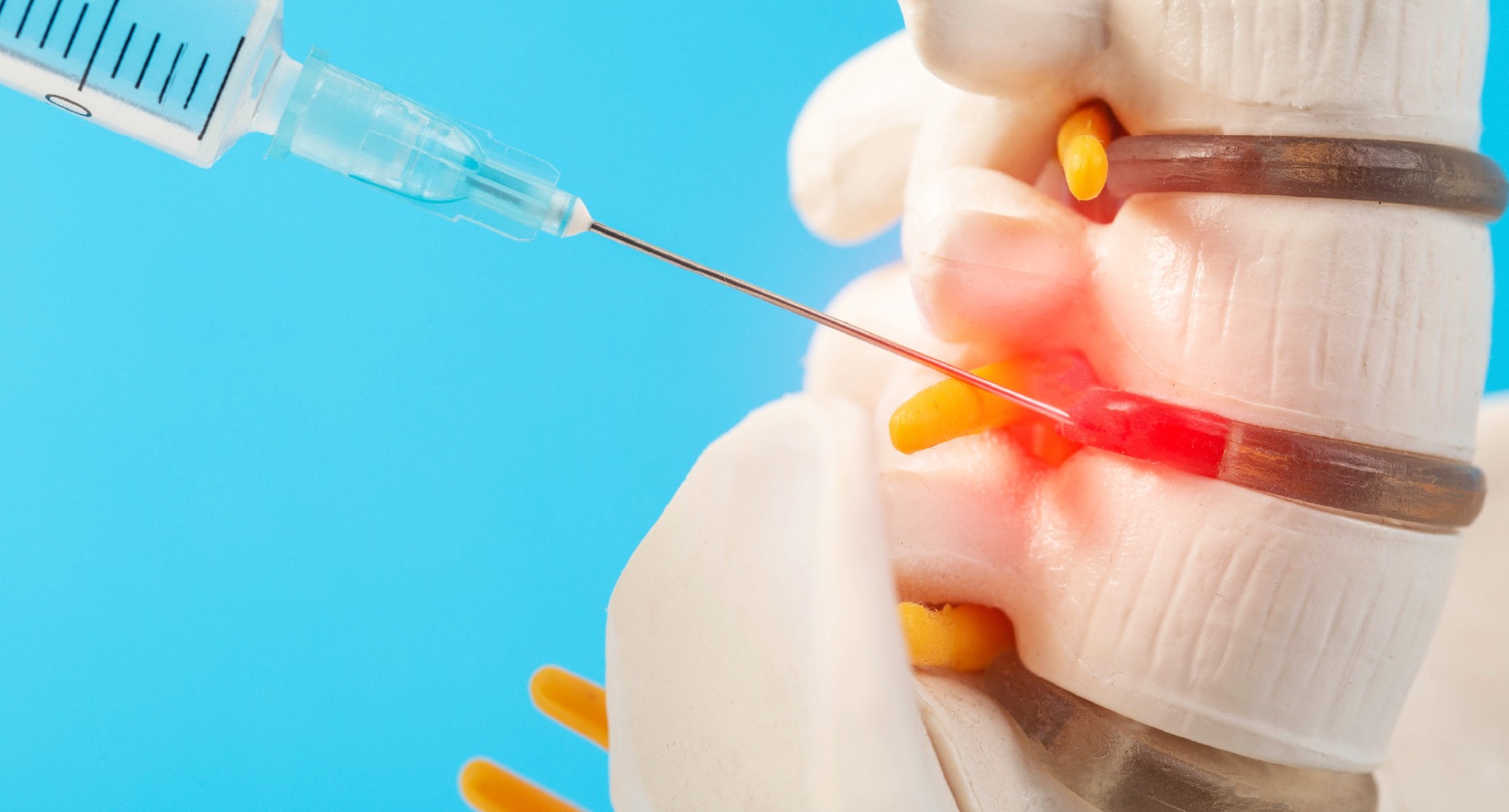 Lumbar Sympathetic Nerve Block | FX Spine & Pain Center Evans, GA