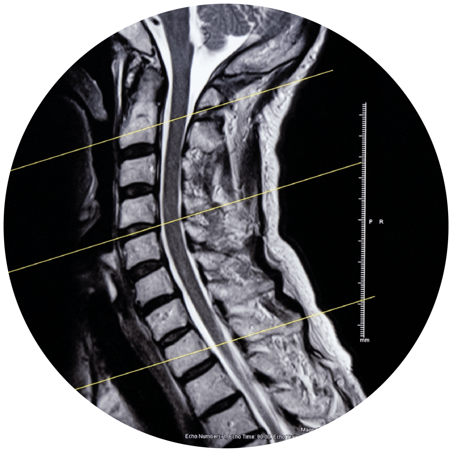 FX Spine & Pain Center | Expert Spine & Pain Care in Evans, GA