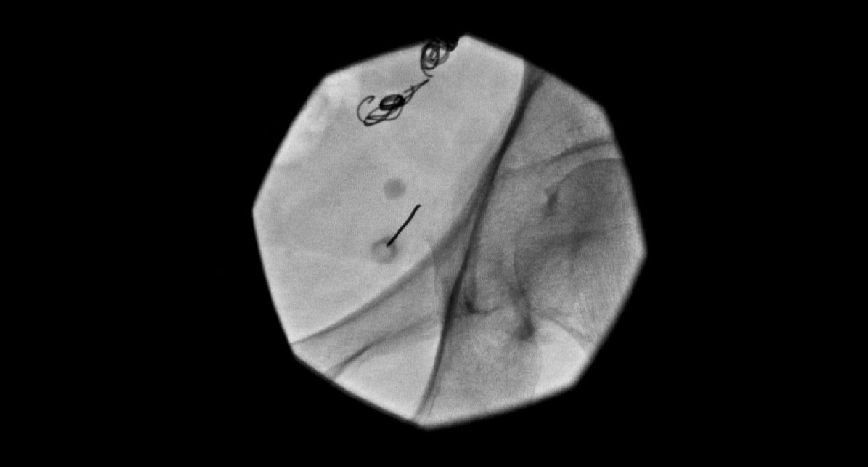 Pudendal Nerve Injections | FX Spine & Pain Center Evans, GA
